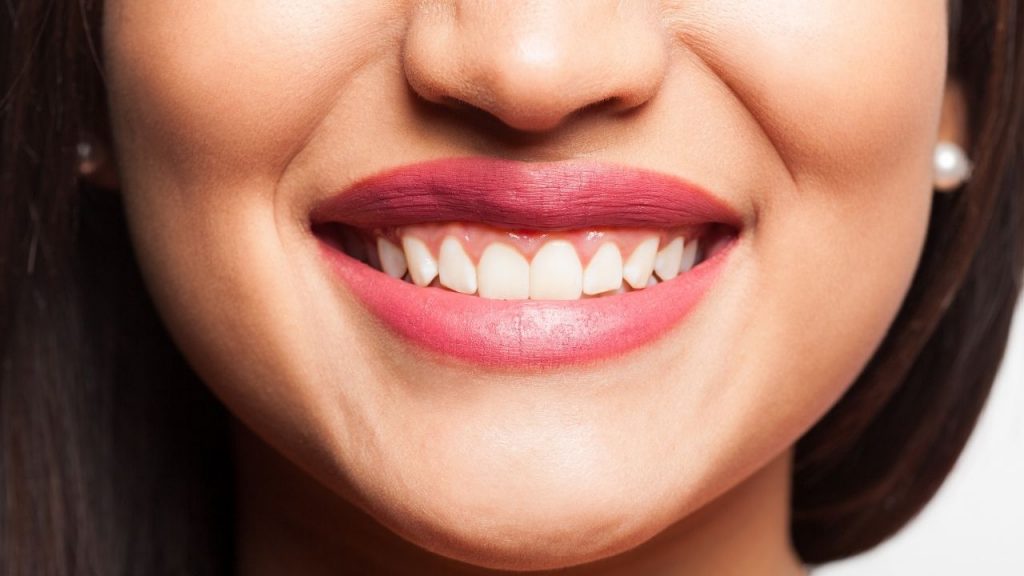 Prótese dentária fixa: o guia completo sobre o tratamento